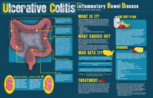 Dieta para personas con Colitis ulcerosa | Tu Salud y Bienestar